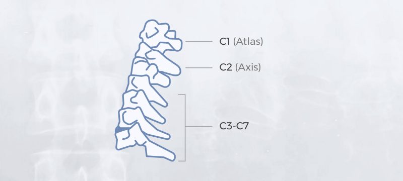 Halswirbelsäule: 7 aufregende Lösungen für Nackenschmerzen
